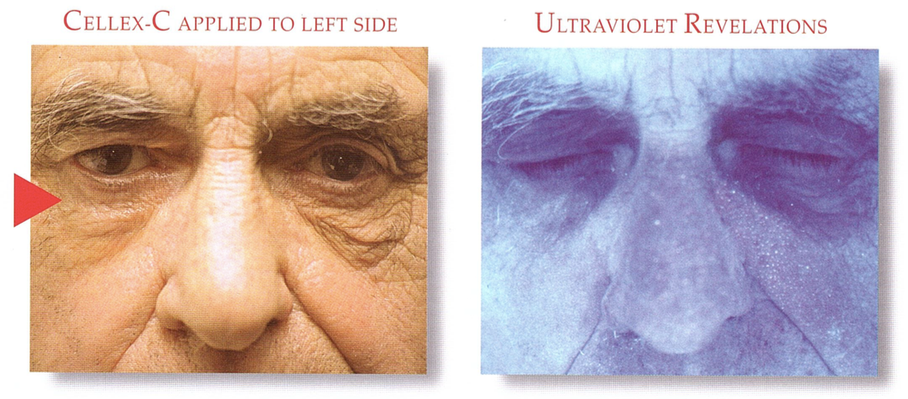 Cellex-C Regimens – CELLEX-C